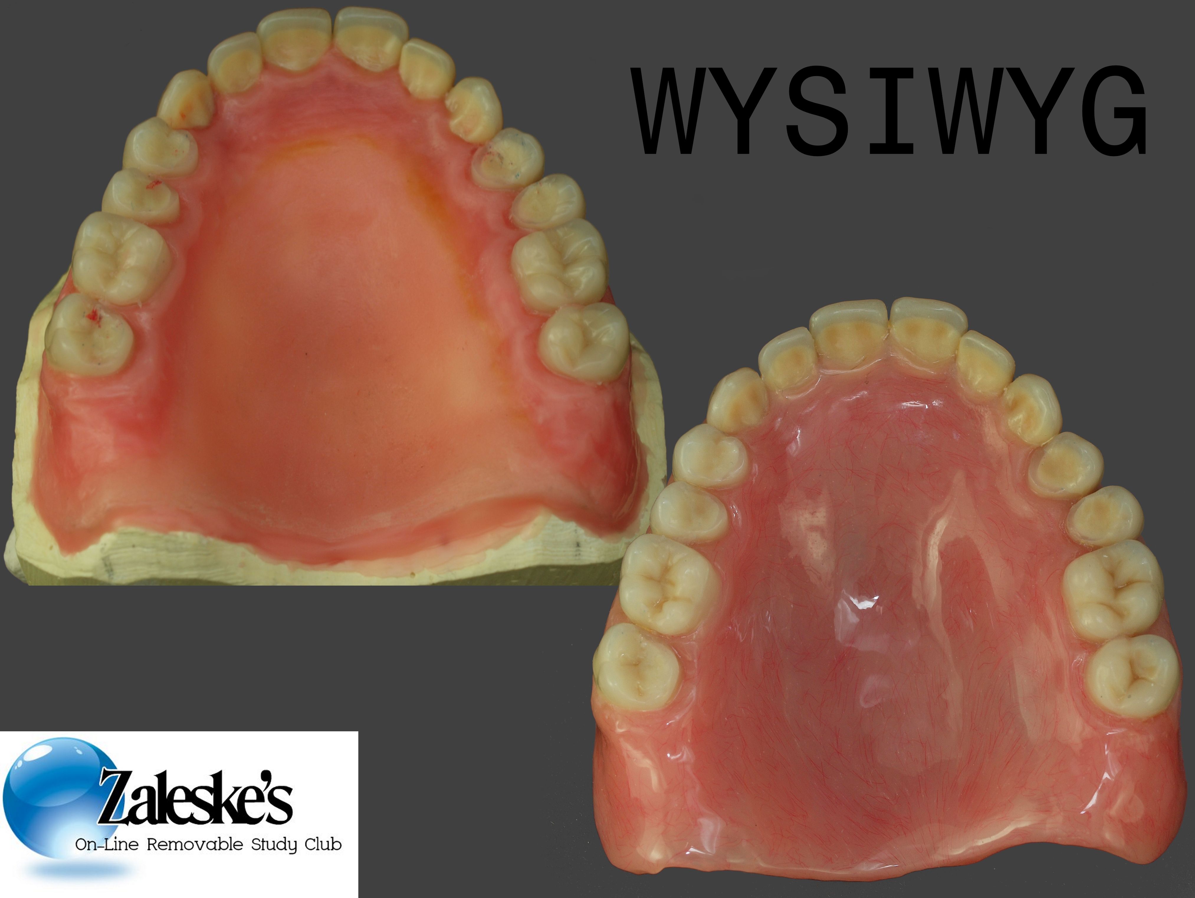 Photographic Portfolio – Matrix Dental Laboratory and Consulting