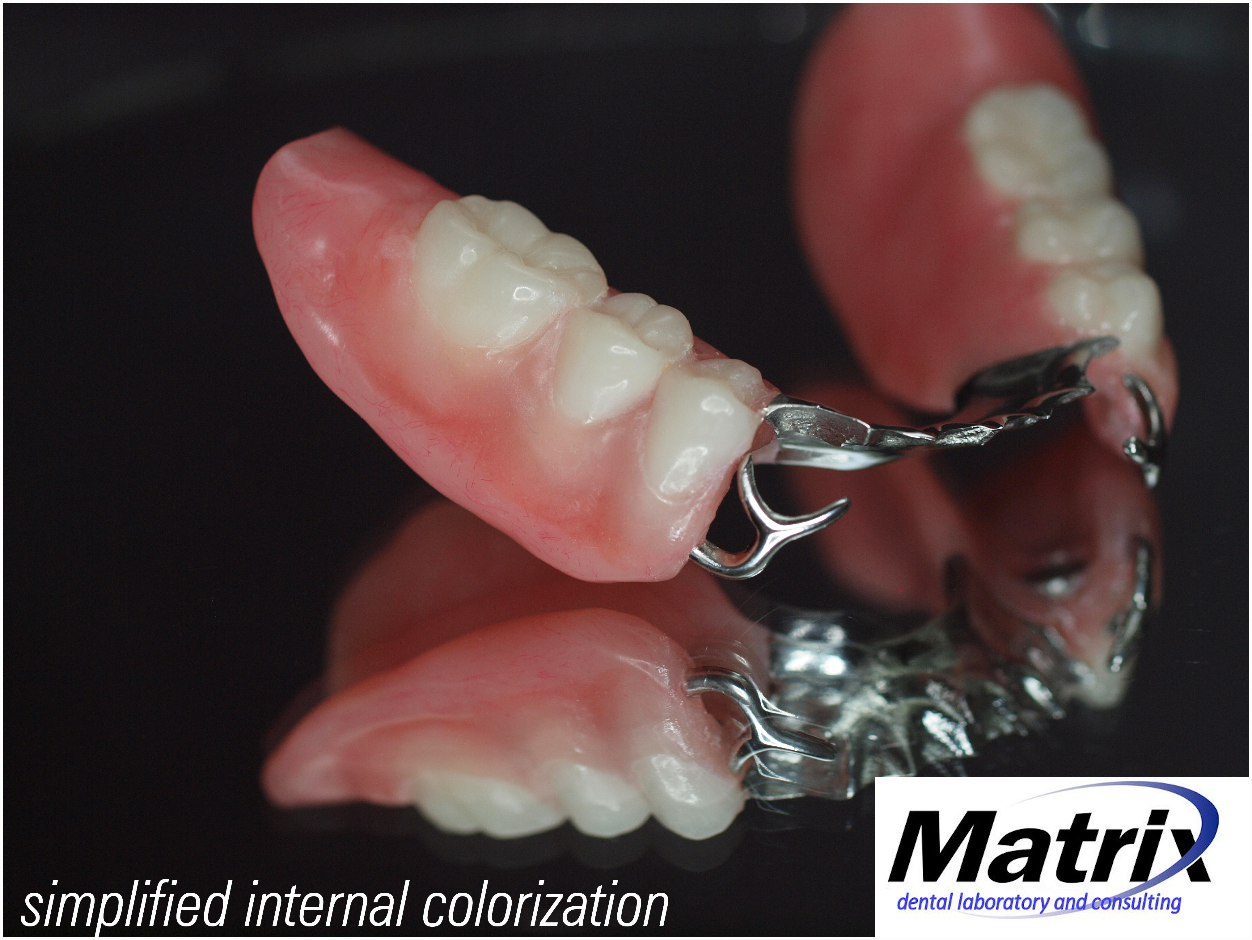 Details Matter – Matrix Dental Laboratory and Consulting