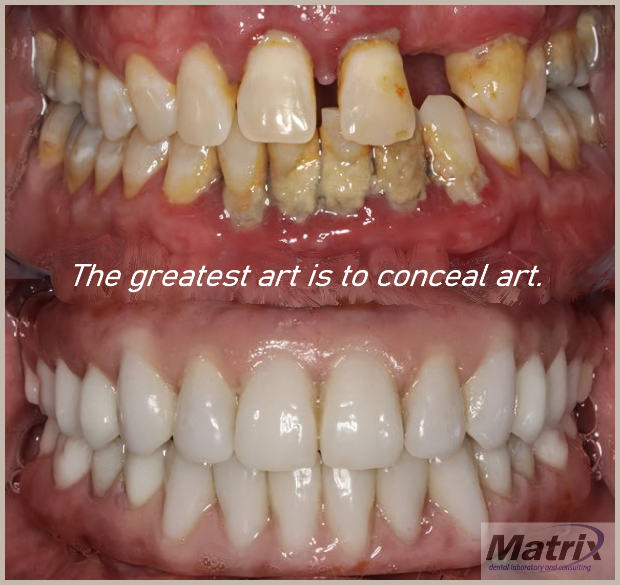Always Striving for Natural – Matrix Dental Laboratory and Consulting