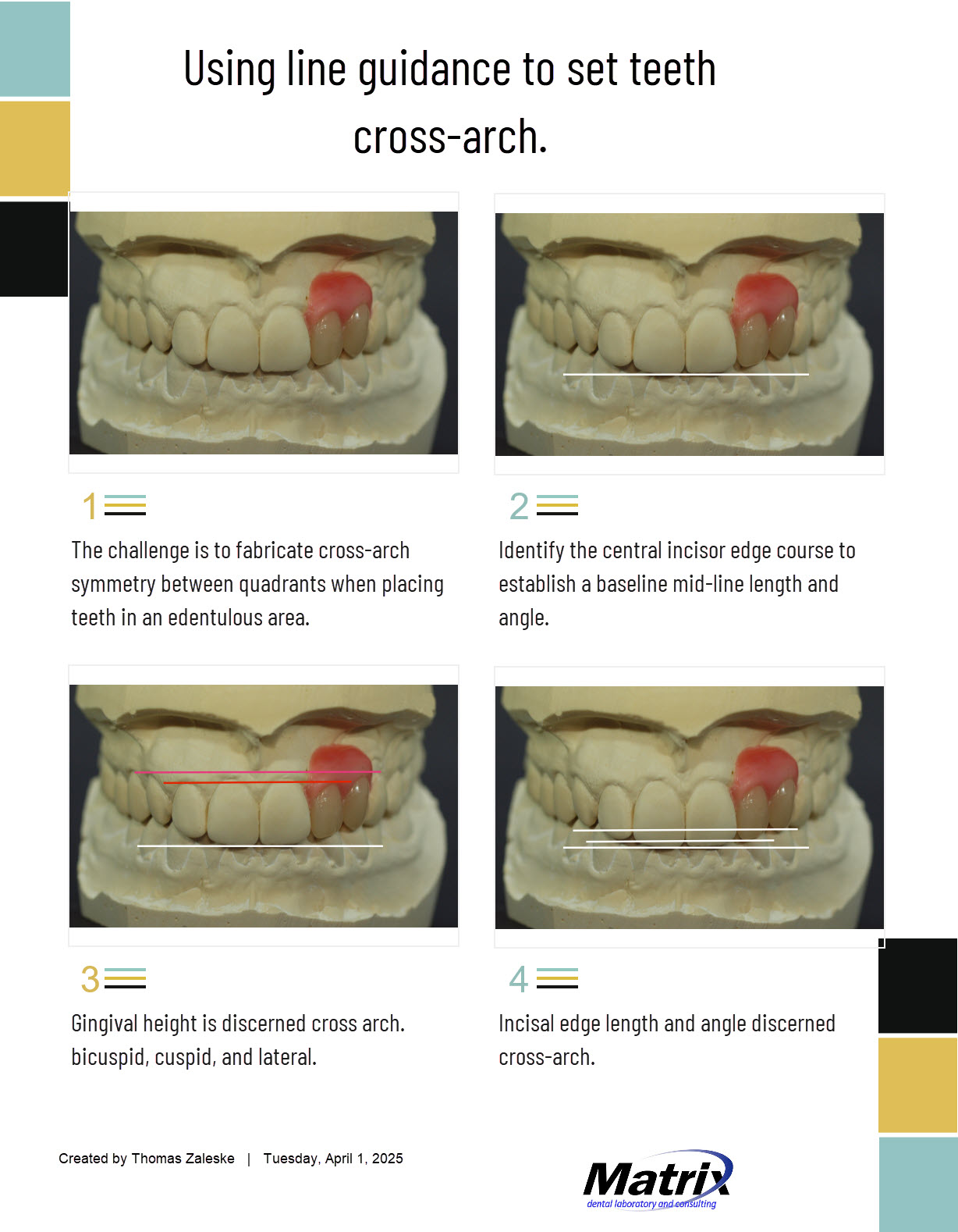 Teaching and performing the highest best. – Matrix Dental Laboratory ...