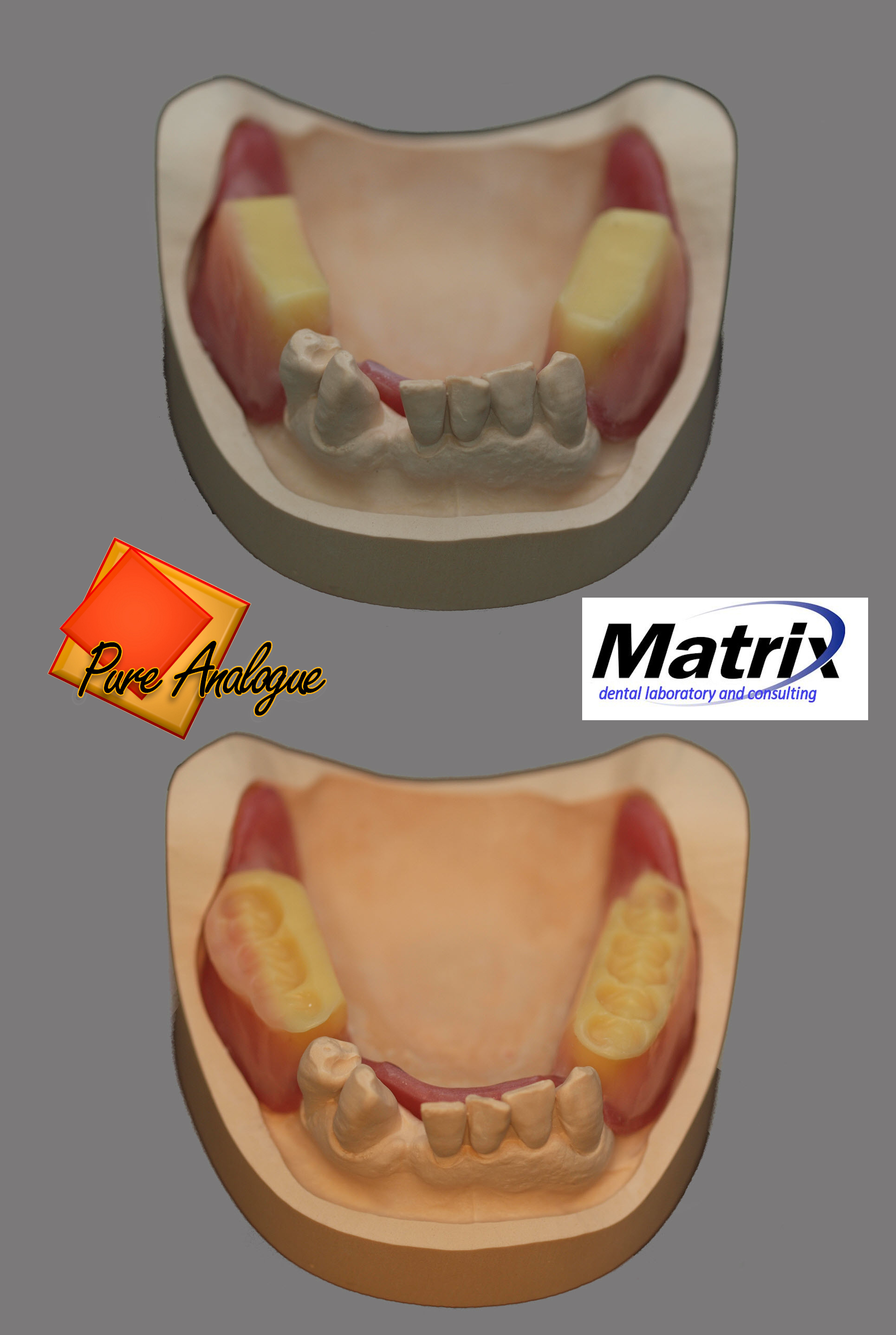 I just can’t help but offer my best. – Matrix Dental Laboratory and ...