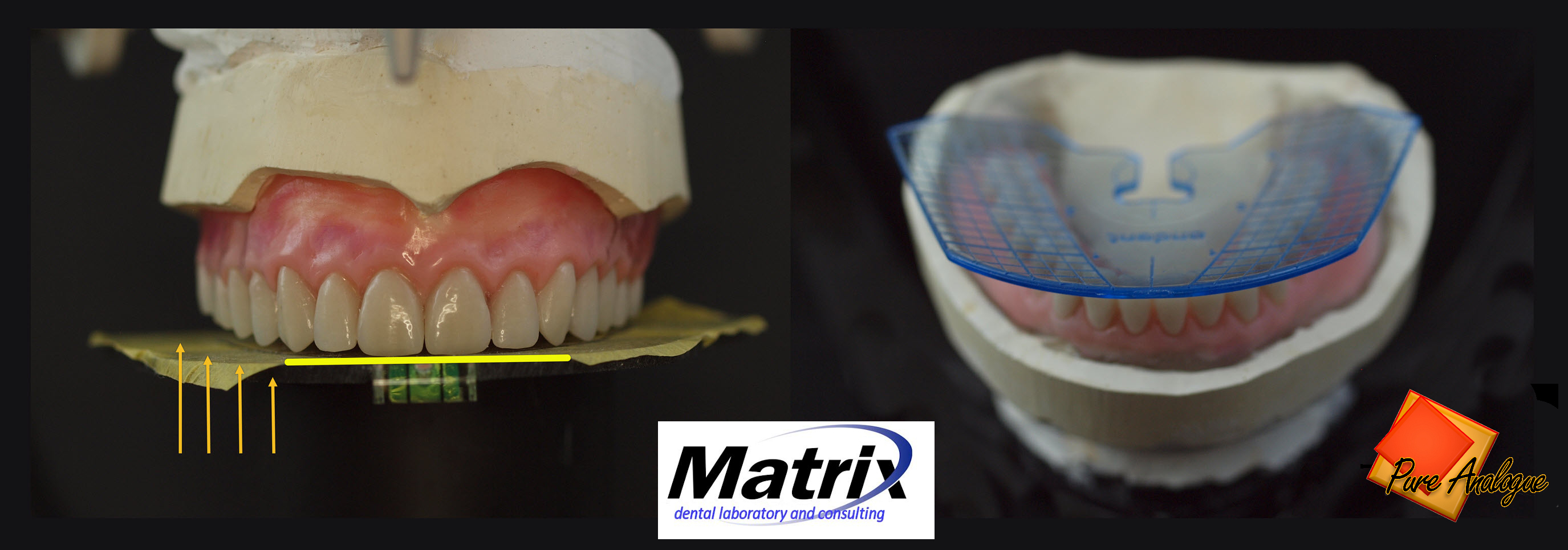 What do you see Part 2 – Matrix Dental Laboratory and Consulting