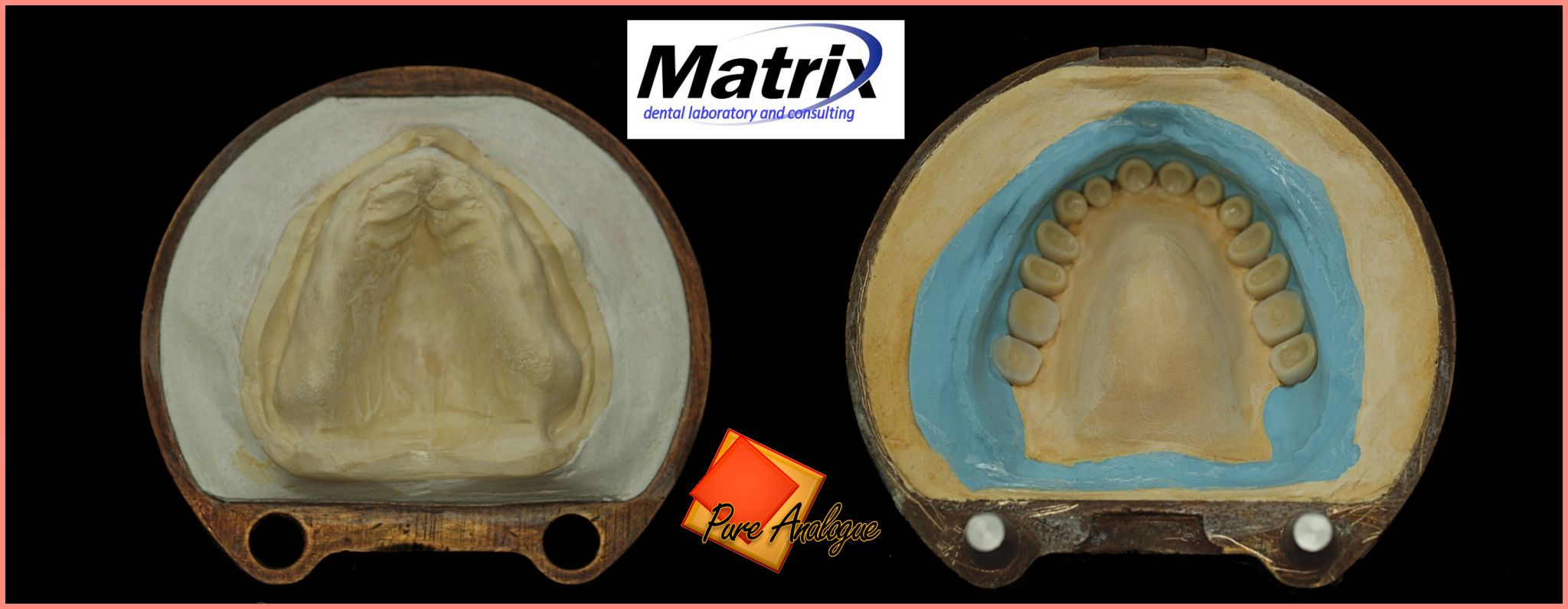 Analogue Fabrication Specialist – Matrix Dental Laboratory and Consulting