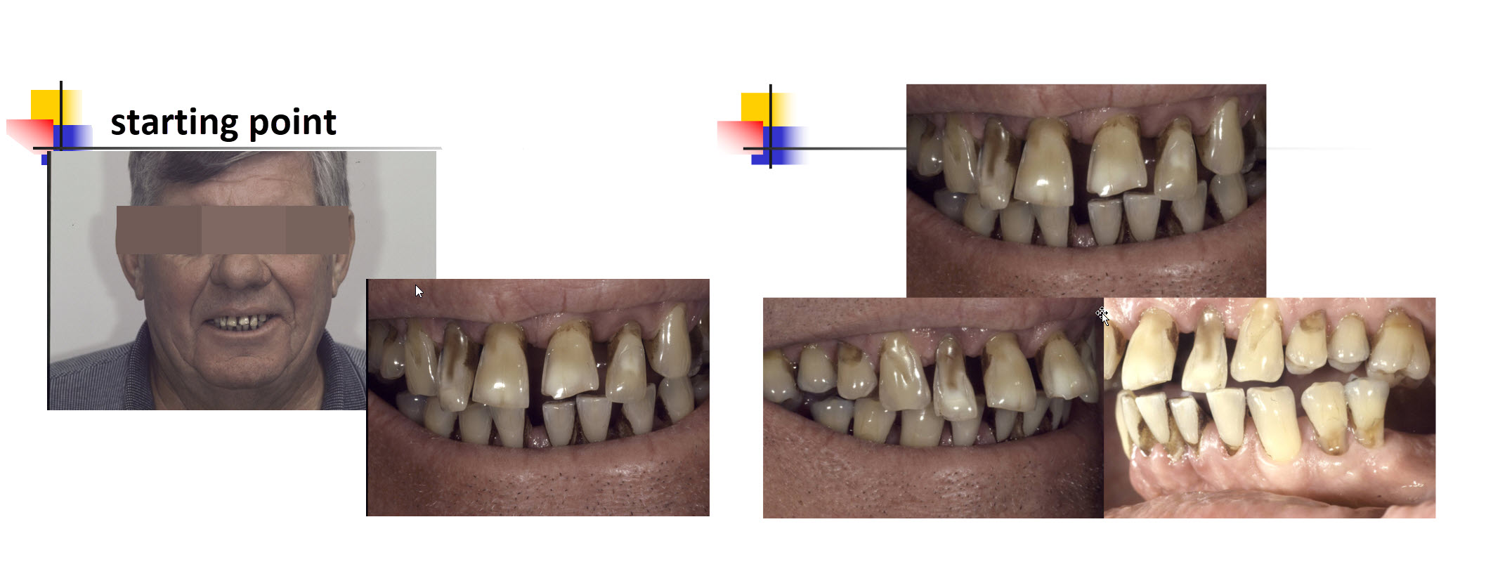 Traditional analog technique specialist – Matrix Dental Laboratory and ...