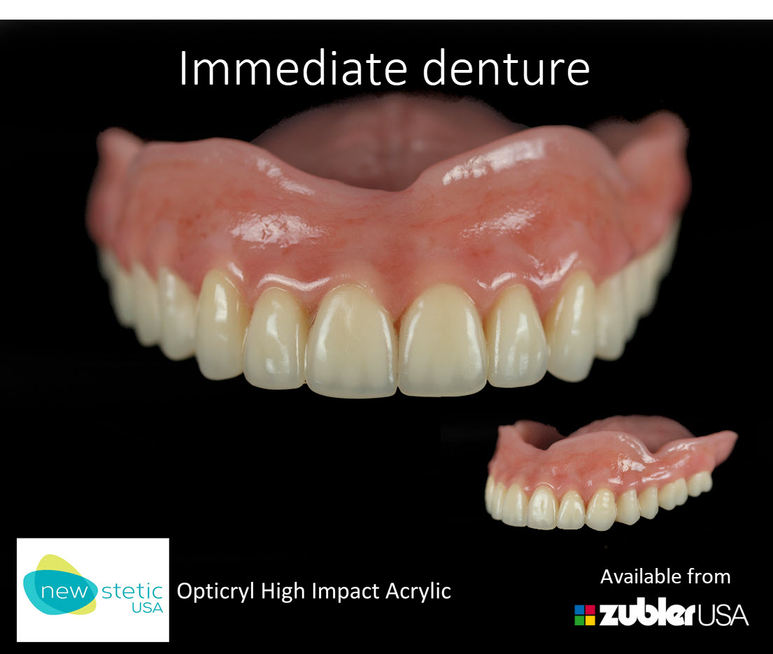 Immediate Denture that reflects high end treatment – Matrix Dental ...